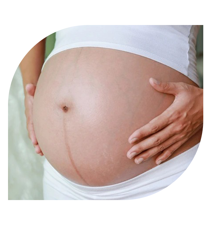 Best VBAC Doctor in Nungambakkam